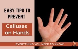 Tips on How to Prevent Calluses on Your Hands - Sasily Skin